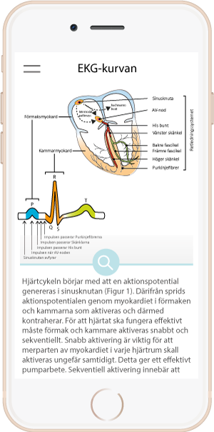 EKG-tolkning, EKG-diagnostik, utredning, behandling och kardiologi - EKG.nu