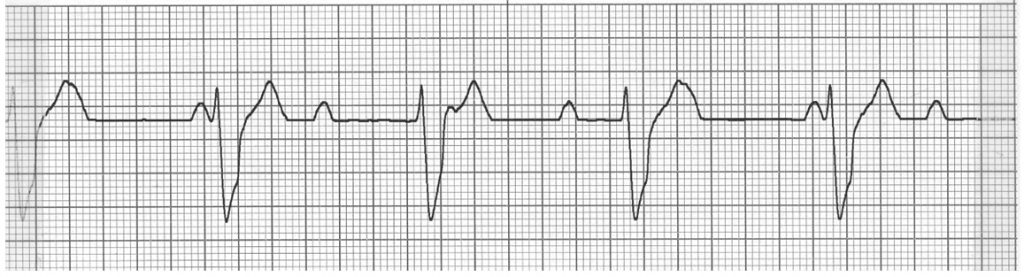 EKG-test 4x – EKG & ECHO