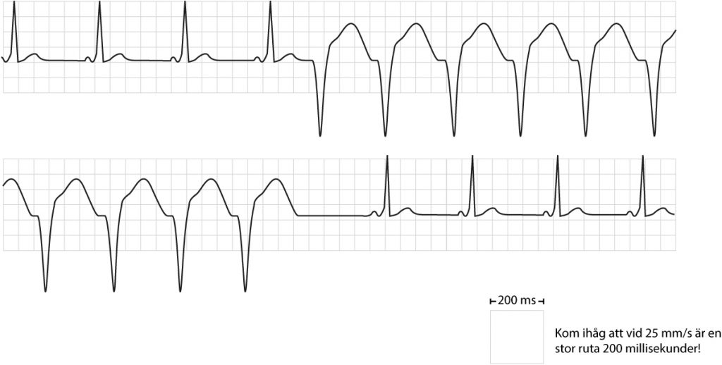 EKG-test 4x – EKG & ECHO