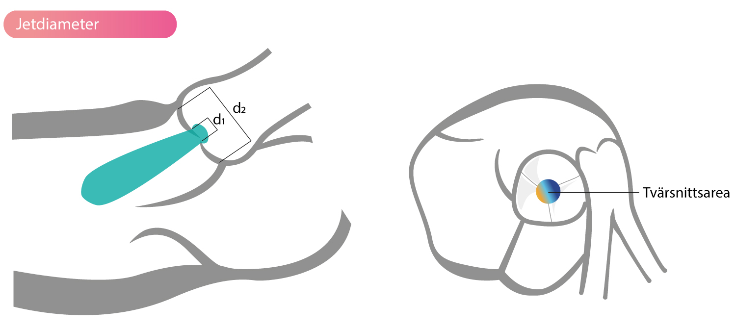 Aortainsufficiens (AR/AI) - Klinisk diagnostik