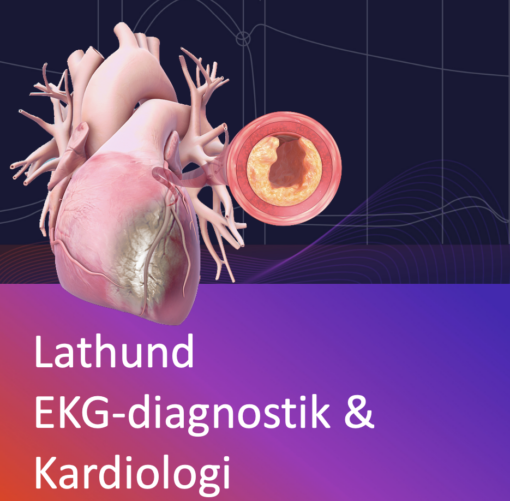 Lungemboli - Symptom, riskfaktorer, utredning, kriterier, behandling